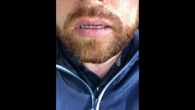 Sfw Behind The Scenes Look At My Newly Untied Tongue Immediately Before And After Surgery Today