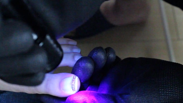 Wrastające Paznokcie U Nóg Leczyć 8 Bez Cenzury