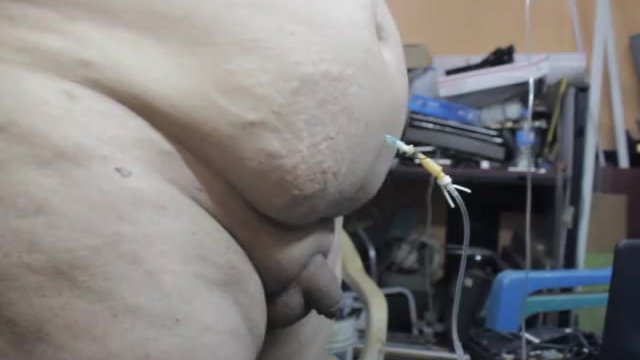Belly Inflation With N2o Part 1 Subscribe Ffor Part 2